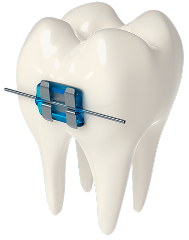 ponle-brackets-a-tus-finanzas - Proyecta tu futuro